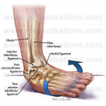 TWISTED ANKLE TREATMENT - Muscle Pull | Muscle Pull